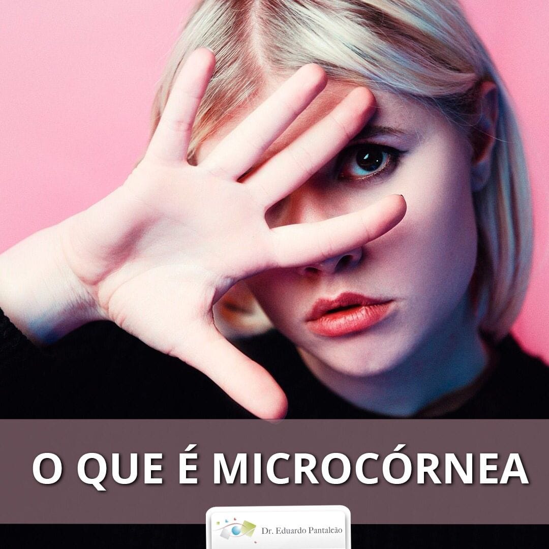 O que é microcórnea? | Dr. Eduardo Pantaleão