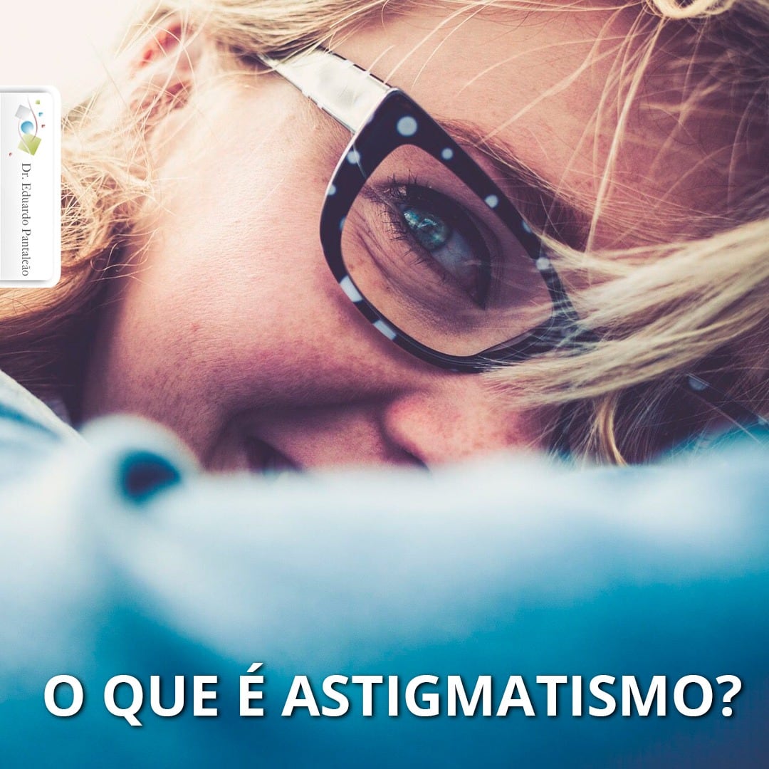 O que é astigmatismo? | Dr. Eduardo Pantaleão