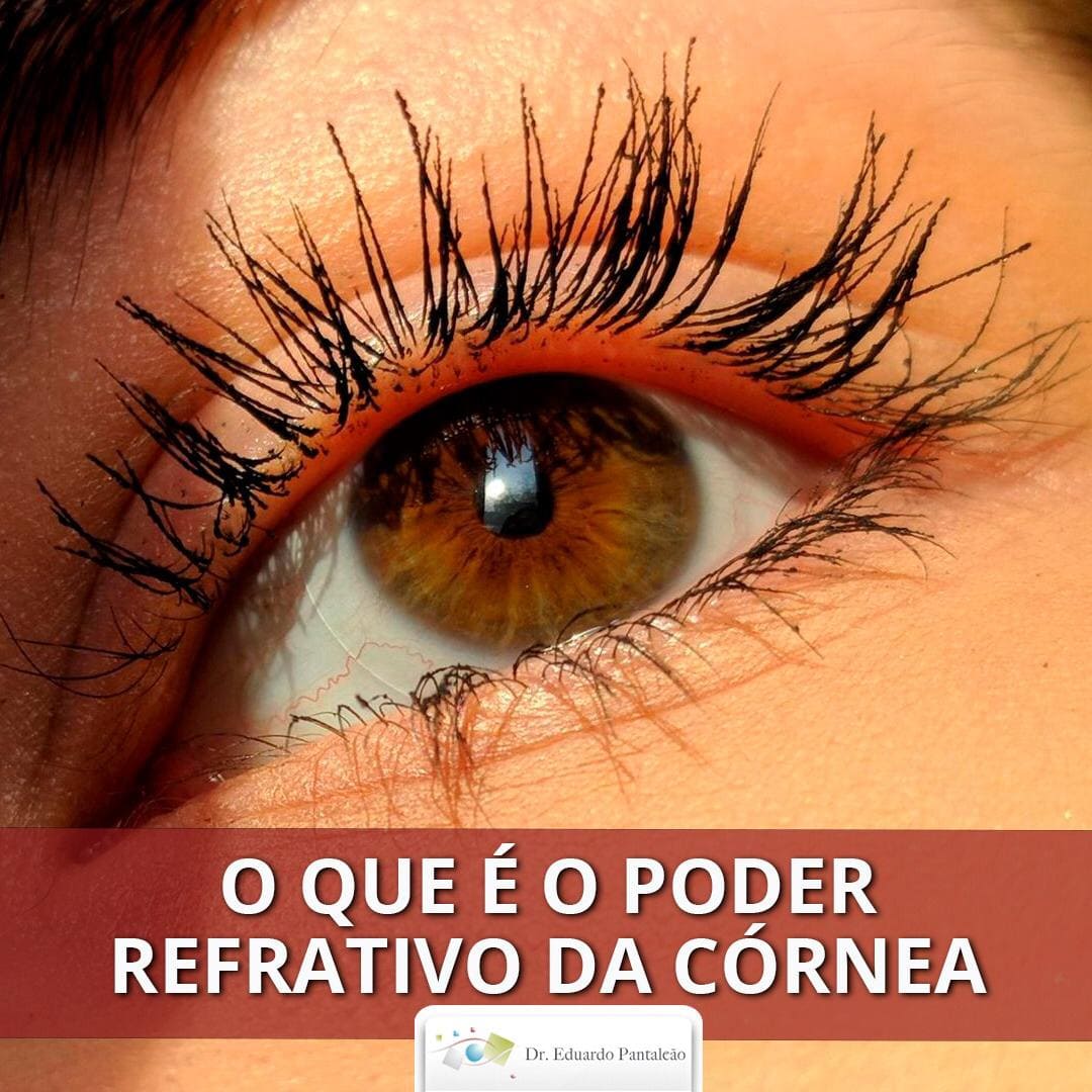 O que é o poder refrativo da córnea? | Dr. Eduardo Pantaleão