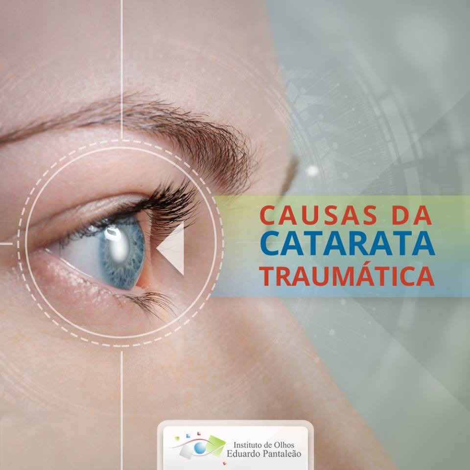 Causas da Catarata Traumática | Dr. Eduardo Pantaleão